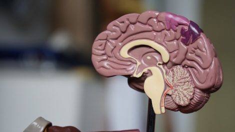What are EEGs, and How Do They Work? - EMR Industry